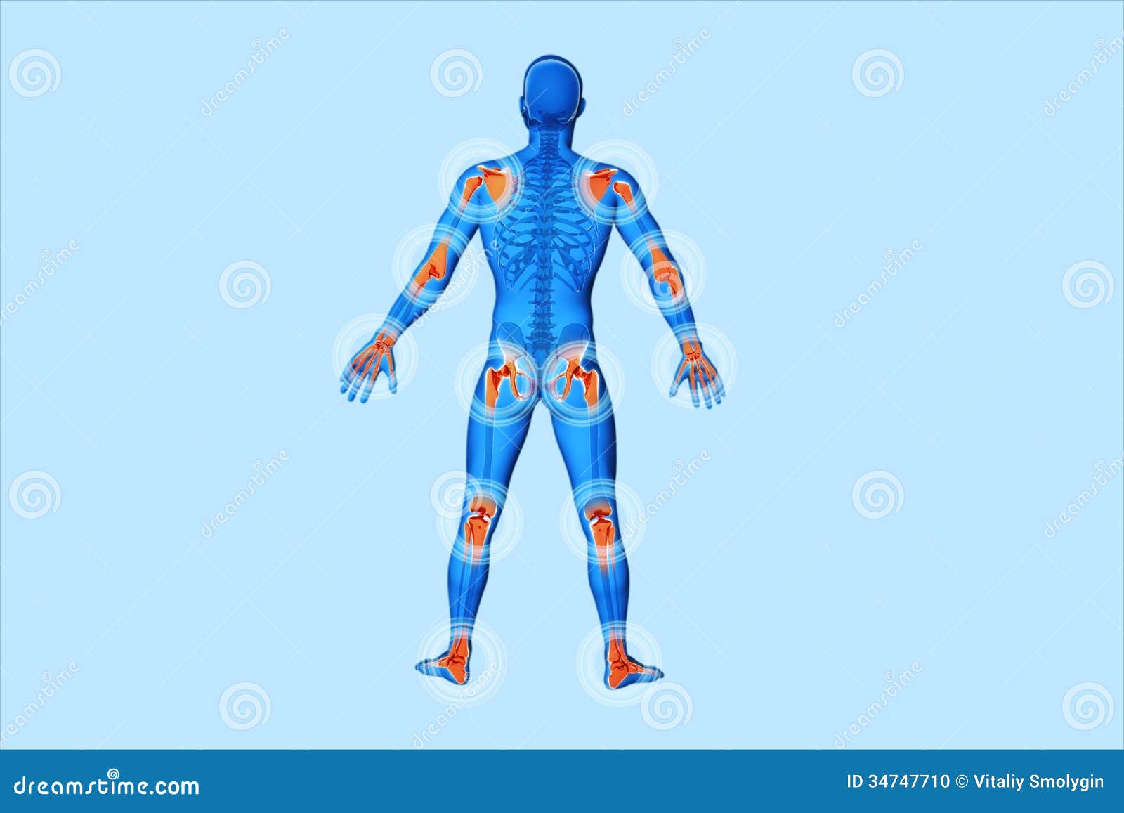 Joints pain - trauma stock illustration. Illustration of drawings ...