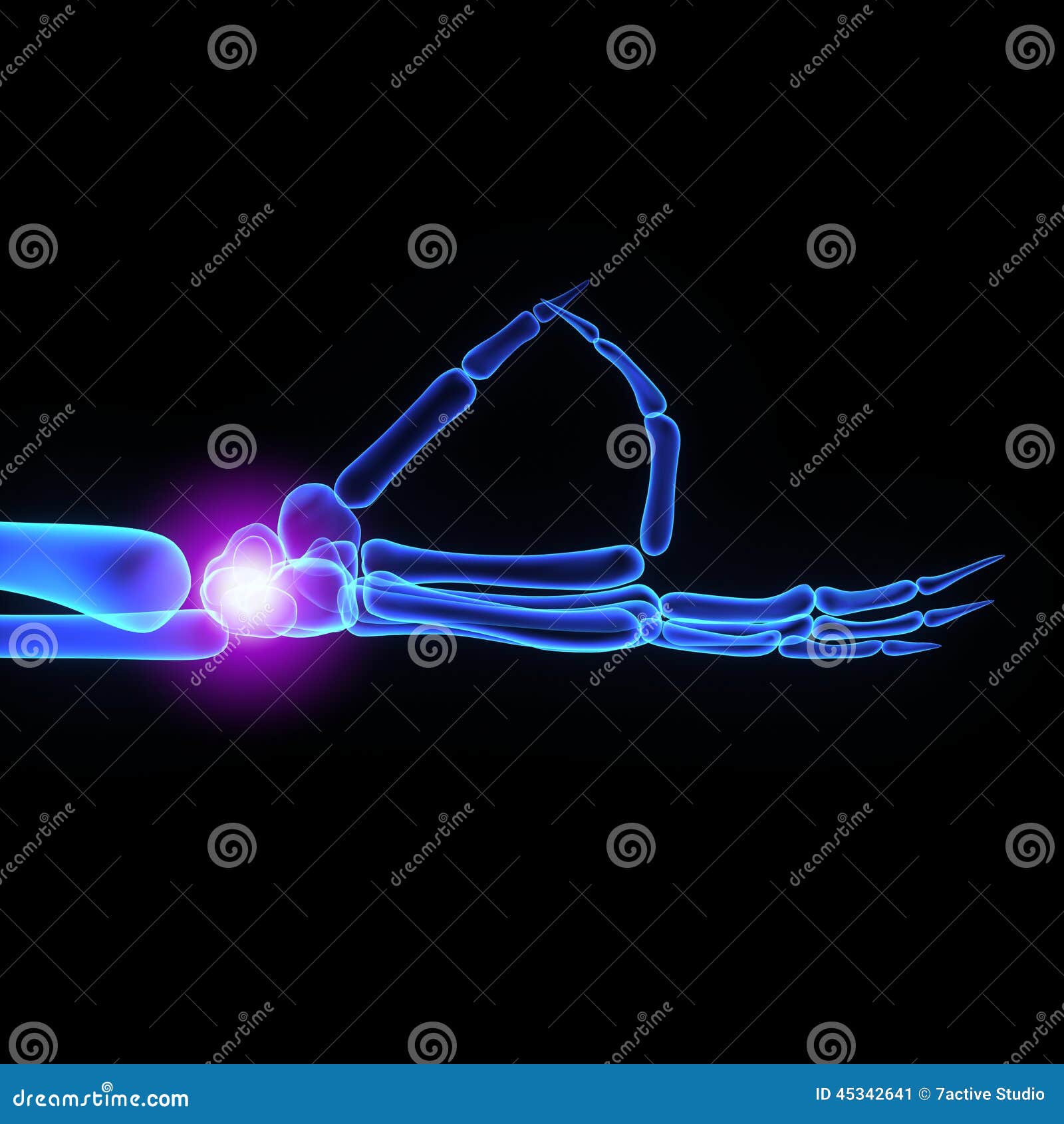 Junções de pulso ilustração stock. Ilustração de ortopédico - 45342641