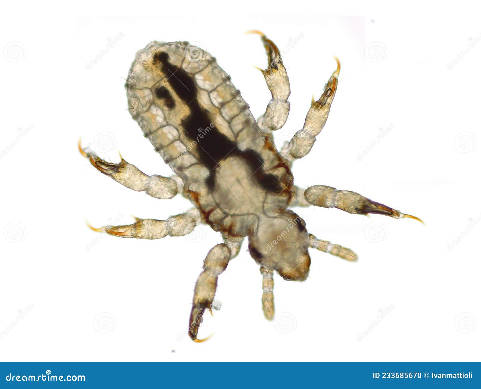 Head Louse, Pediculus Humanus, Under The Microscope Royalty-Free Stock ...