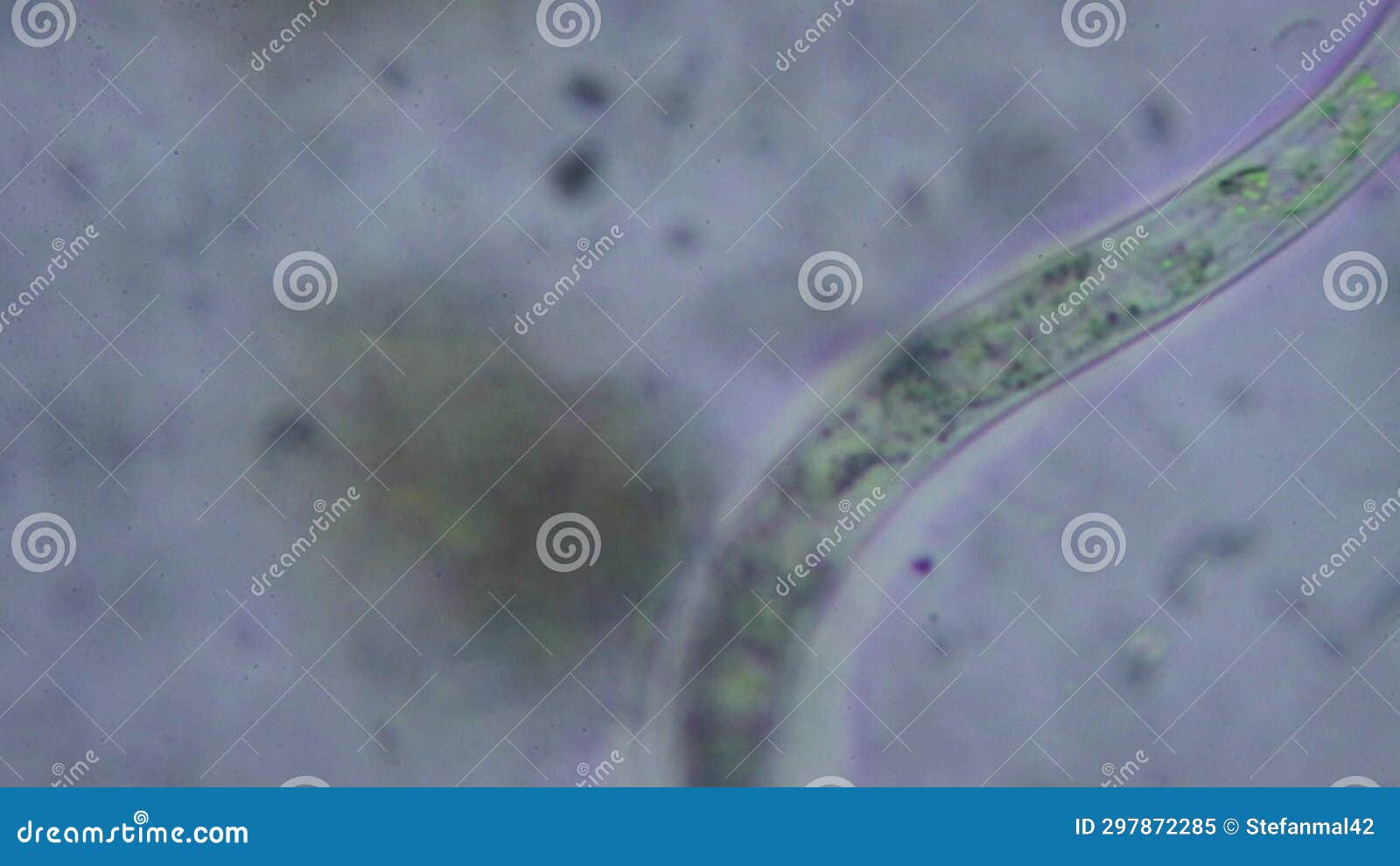 4k Footage of a Nematode Under a Microscope at Different Magnification ...