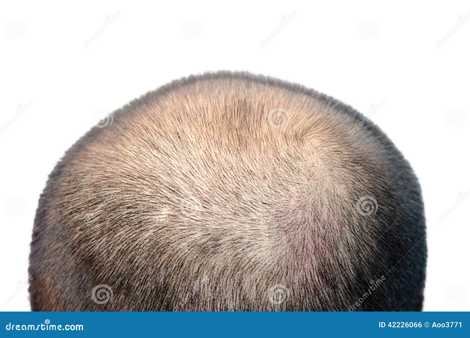 Kaal hoofd stock foto. Image of patroon, mening, mannetje - 42226066