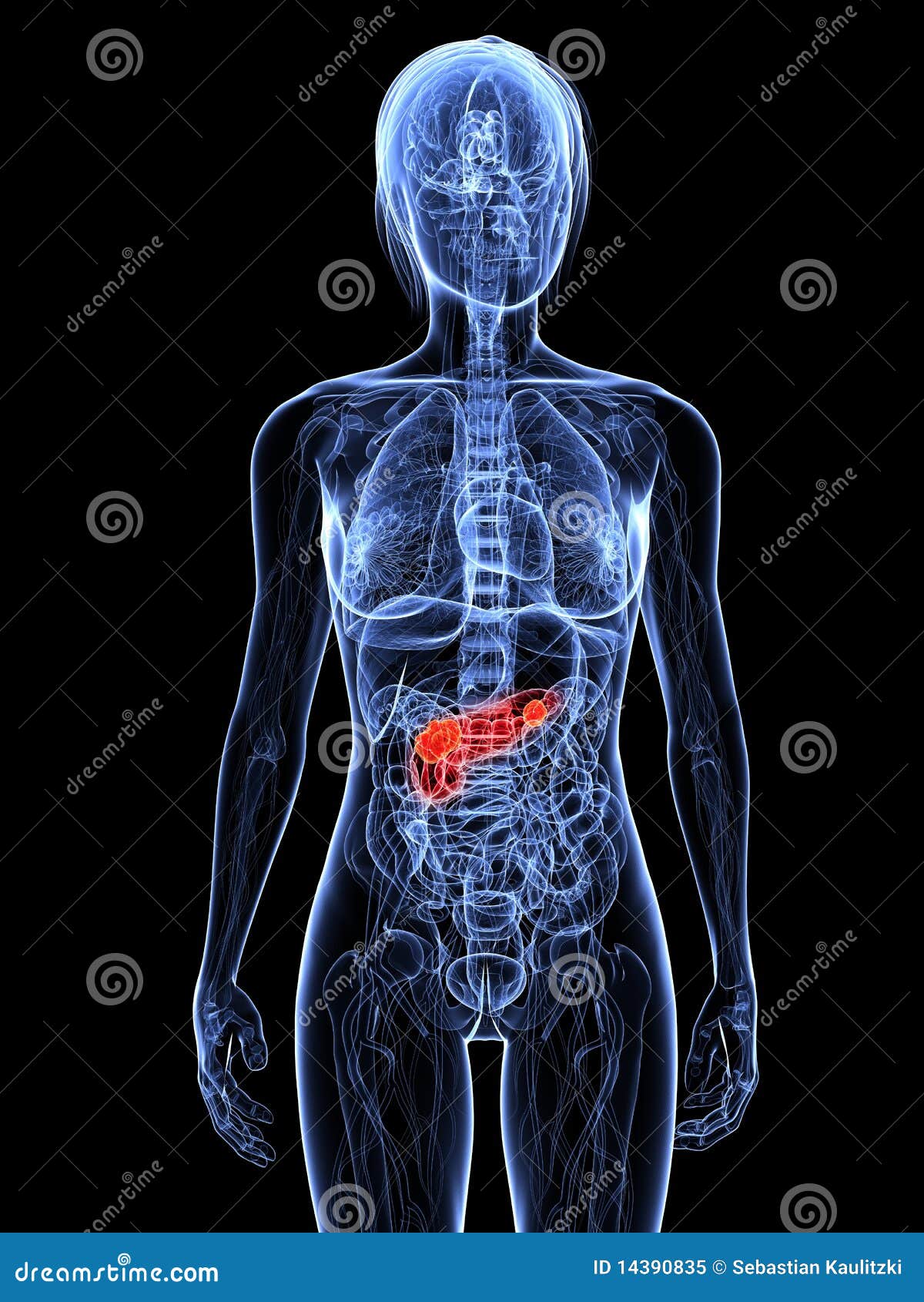 Kanker van de alvleesklier stock illustratie. Illustration of darm ...