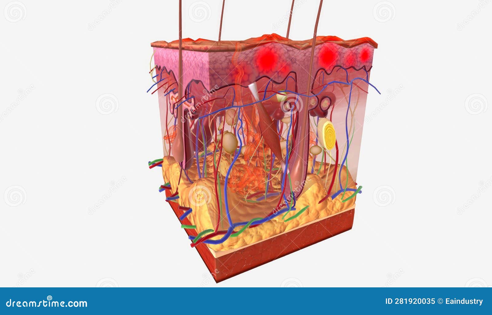 Kaposi is Sarcoma is a Type of Cancer that Forms in the Lining of Blood ...
