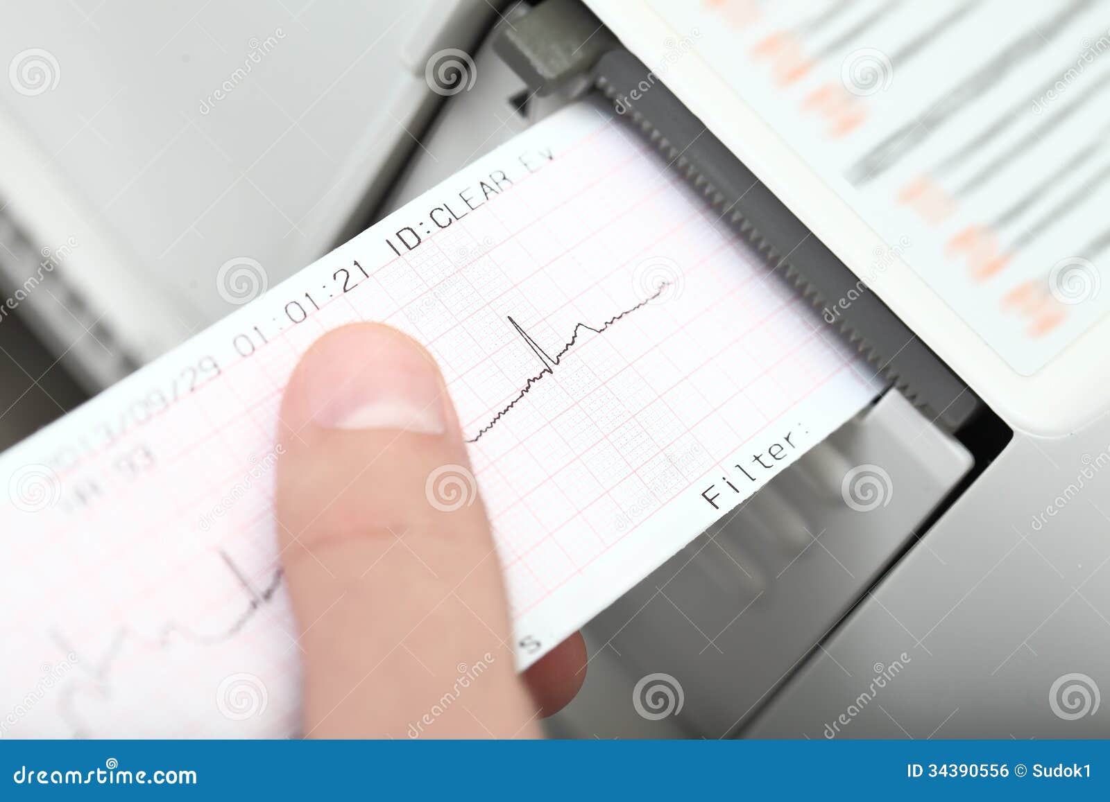 Kardiogram och kardiograf arkivfoto. Bild av doktor, abstrakt - 34390556