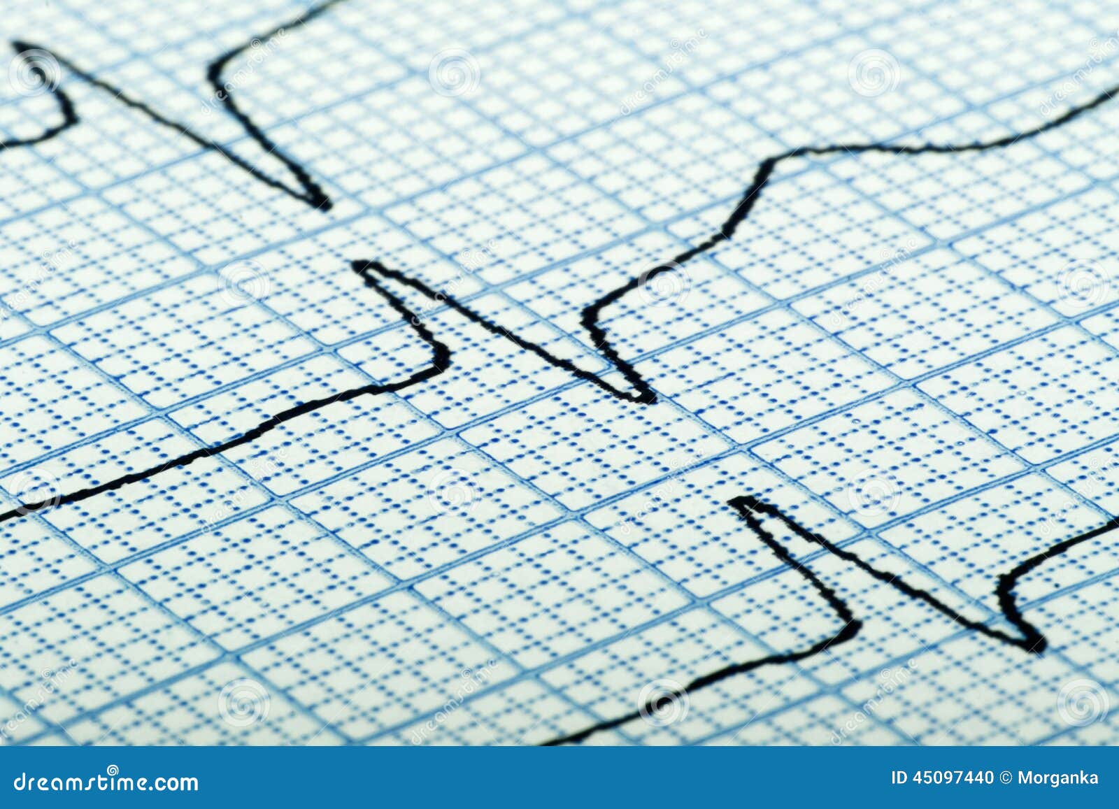 Kardiogramm Des Herzschlages Stockfoto - Bild von kardiologie, zeile ...