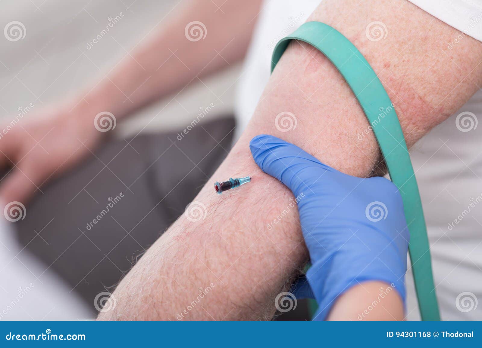 Katheter Gelegt in Die Ader Stockfoto - Bild von geduldig, aderpresse ...