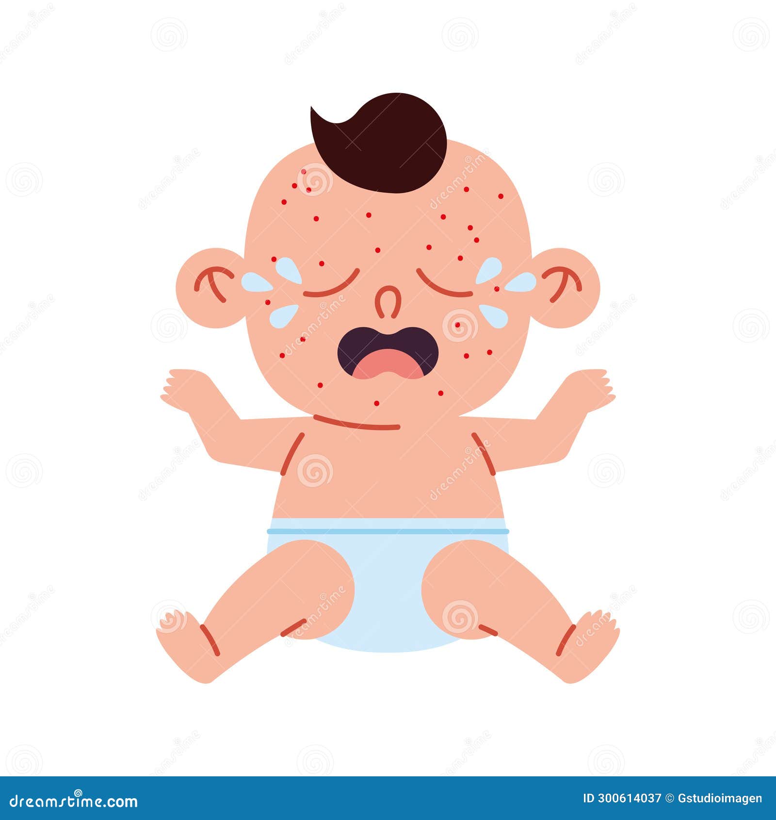 Kawasaki Disease On A Baby Royalty-Free Stock Photo | CartoonDealer.com ...