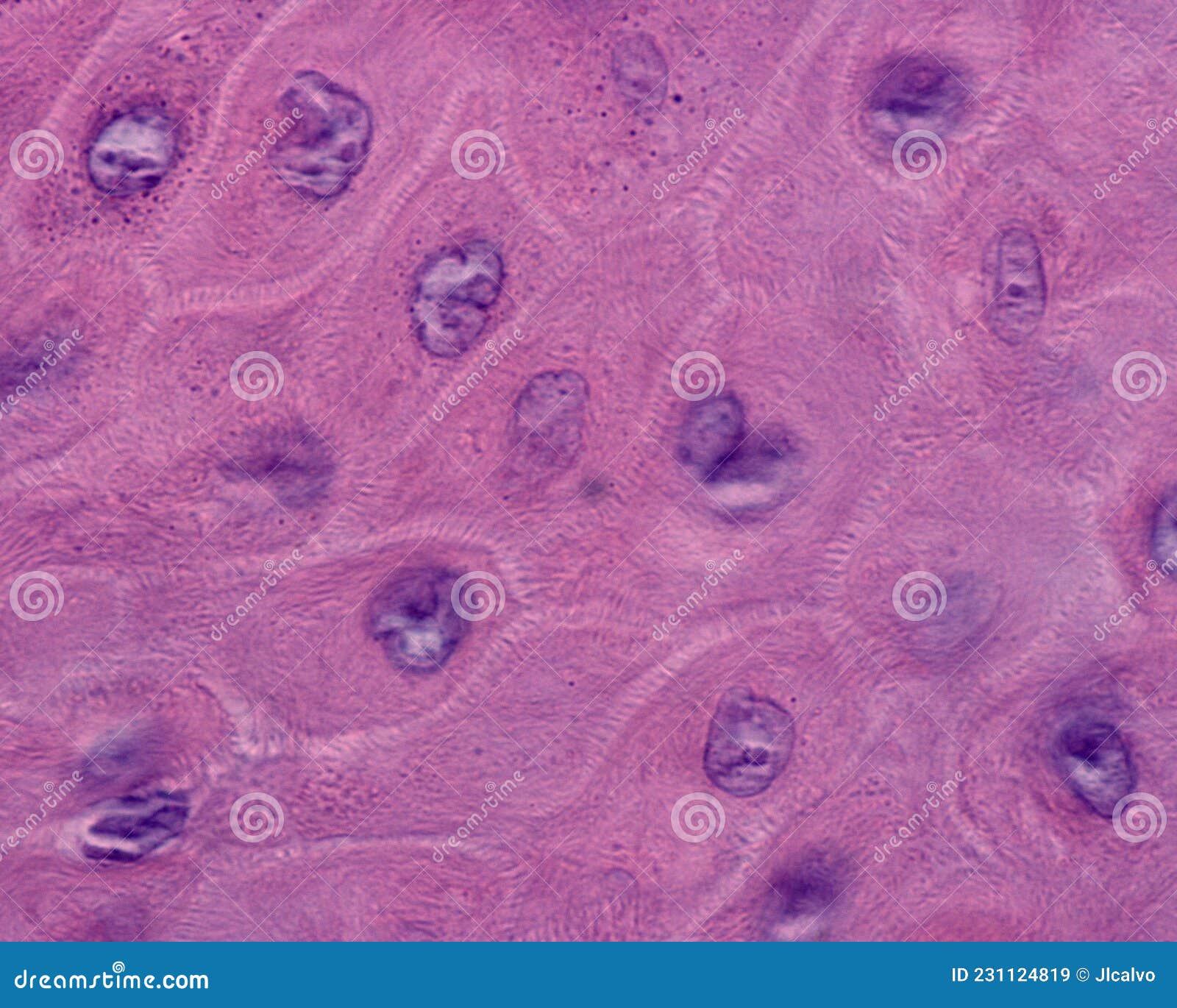 Epidermis. Spinous layer stock image. Image of epithelial - 231124819