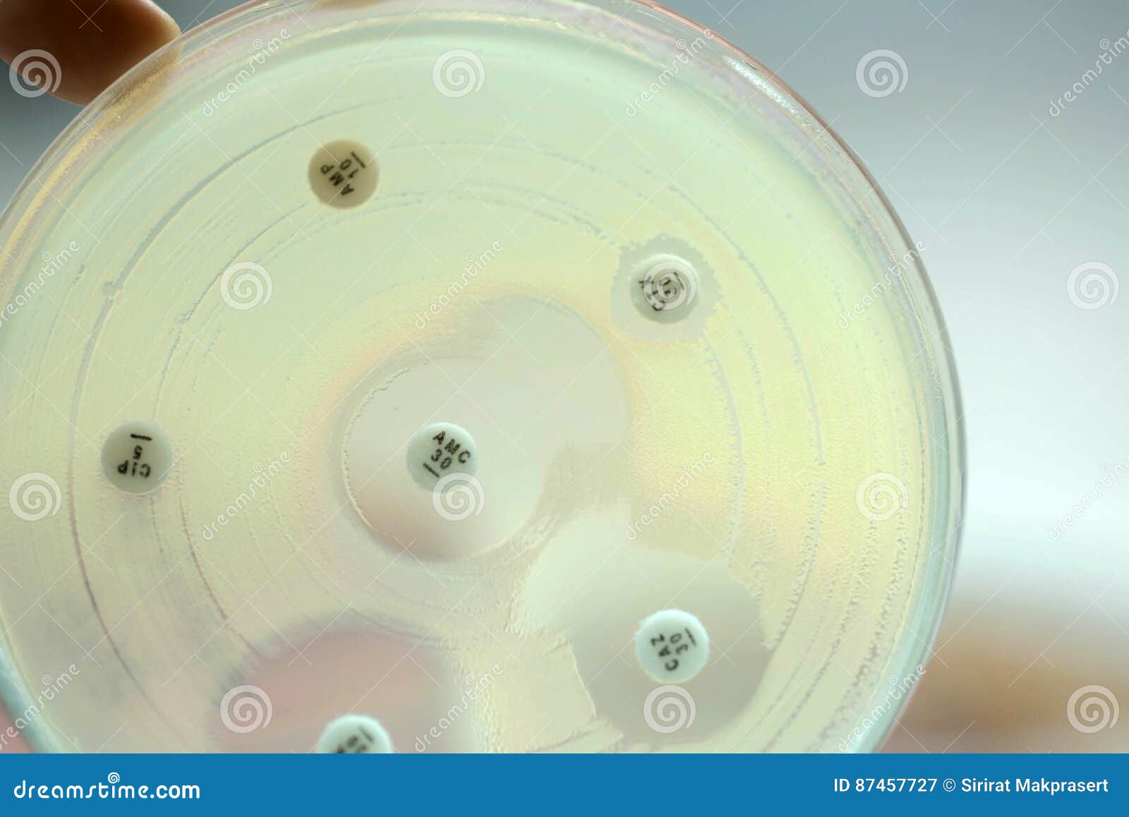 Keyhole Test ESBLs Positive by Diffusion Method Test for Gram Ne Stock ...