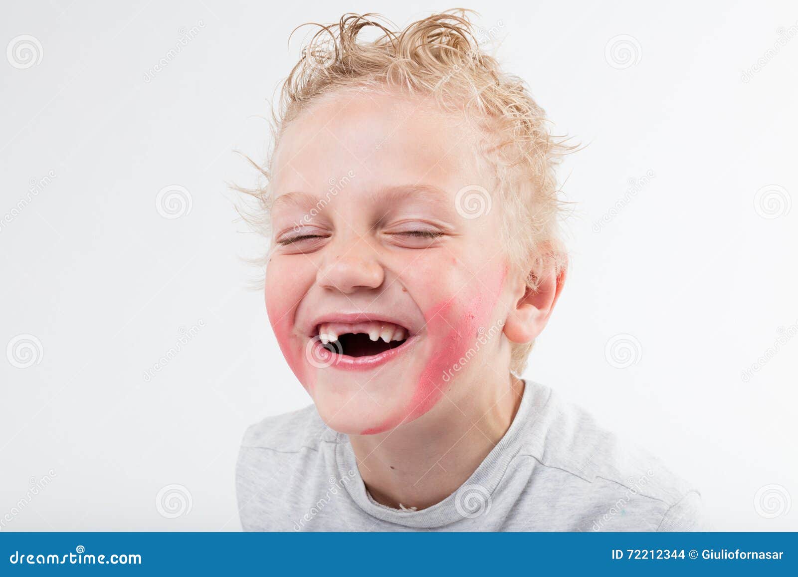 Kid Baring His Windowed Teeth Laughing Stock Photo - Image of ...
