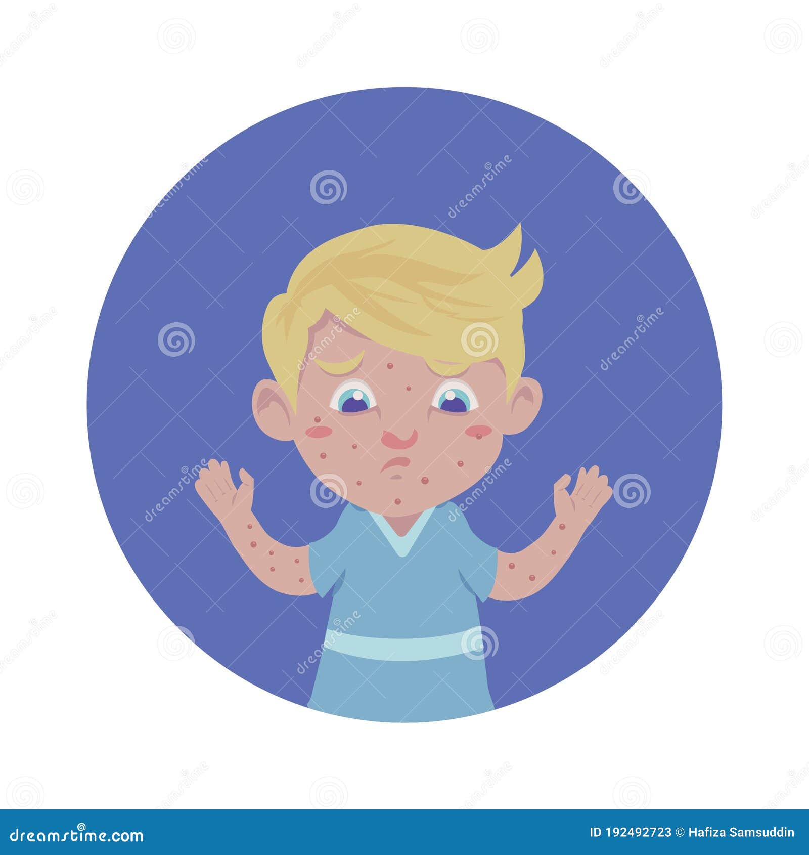 Kid with Chickenpox. Vector Illustration Decorative Design Stock Vector ...