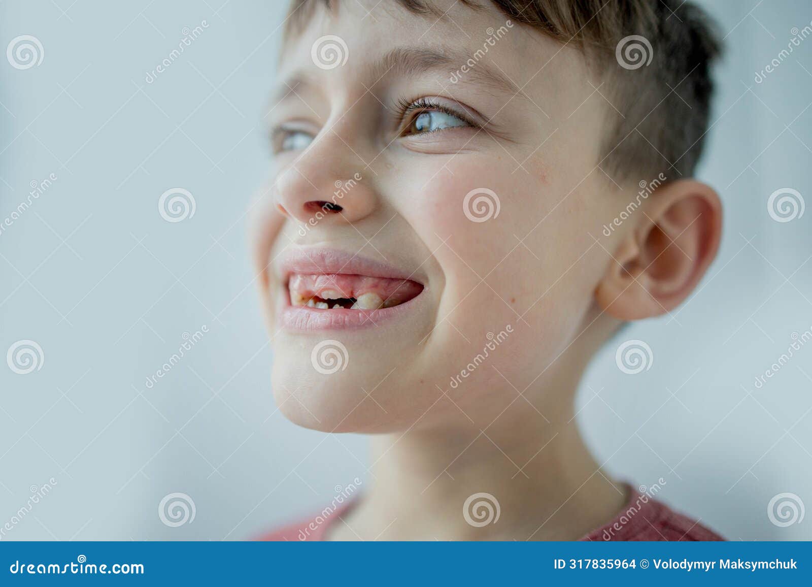 Kid Losing a Baby Tooth and a New Permanent Tooth Coming Out Stock ...