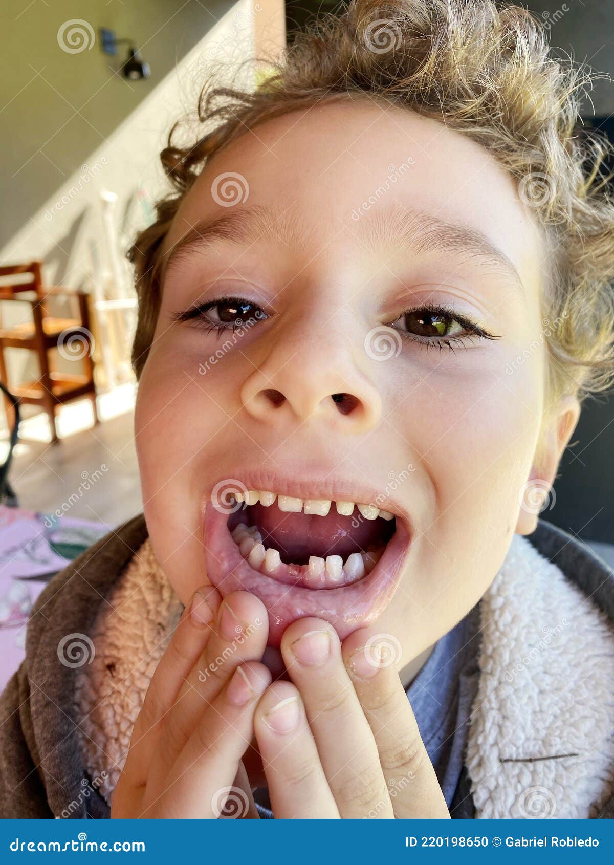 Kid with missing teeth stock photo. Image of missing - 220198650
