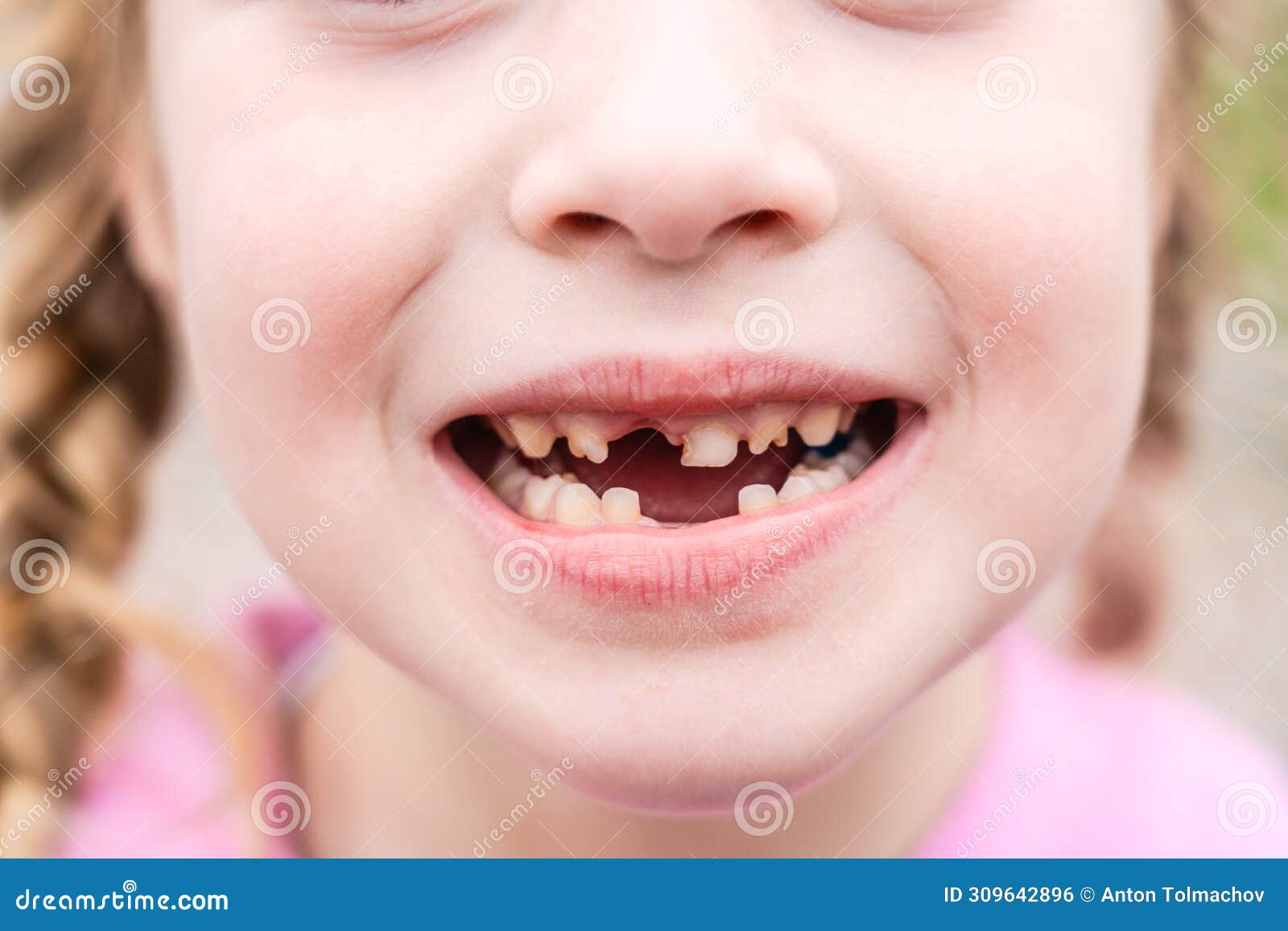Kid Shows Off First Missing Tooth. Children without One Tooth Smiles ...