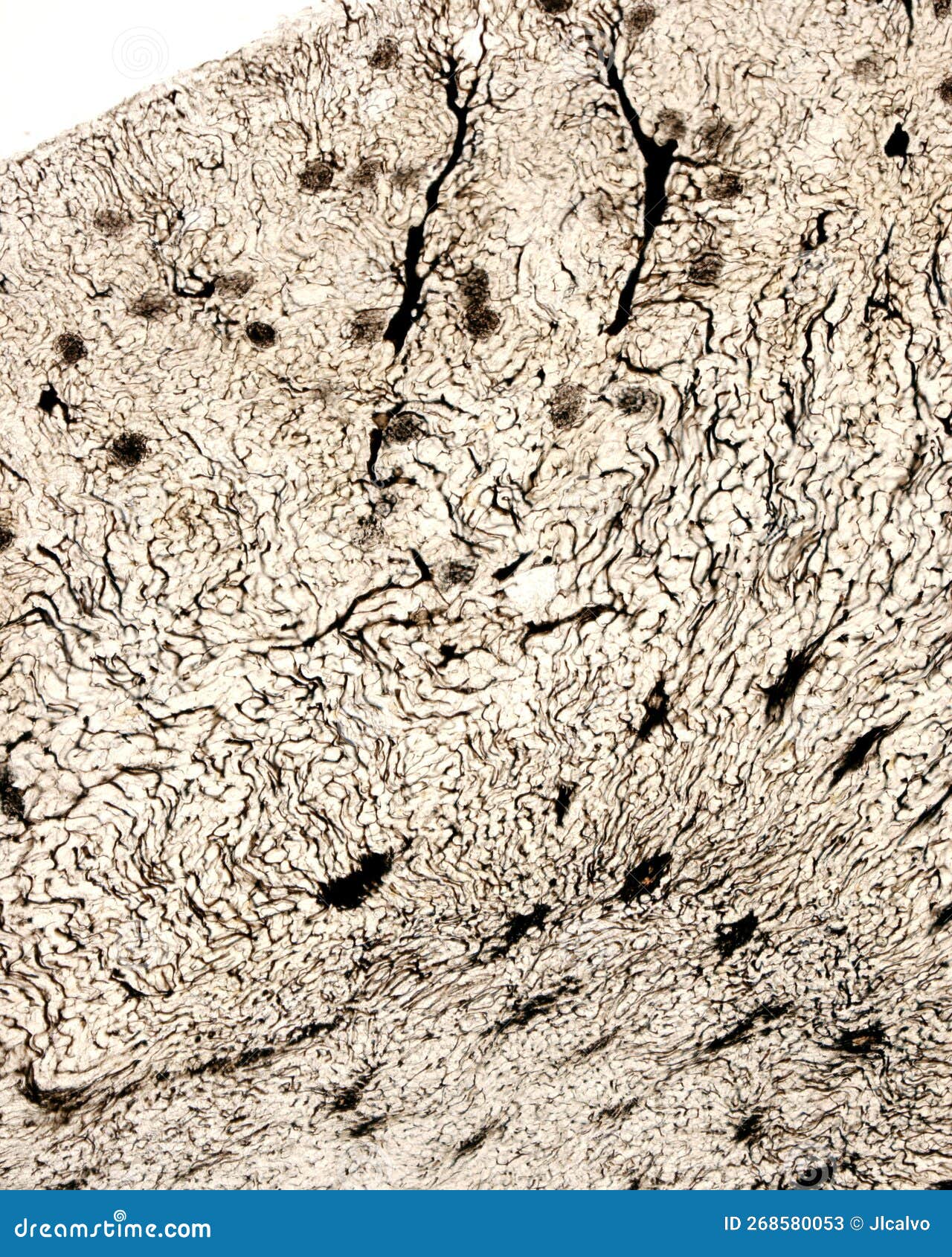 Kidney. Blood vessels stock image. Image of indian, blood - 268580053