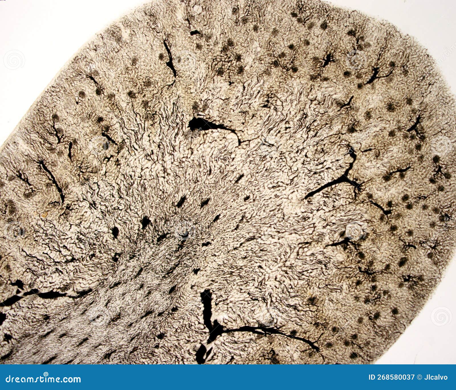 Kidney Medulla. Bellini Ducts Royalty-Free Stock Photo | CartoonDealer ...