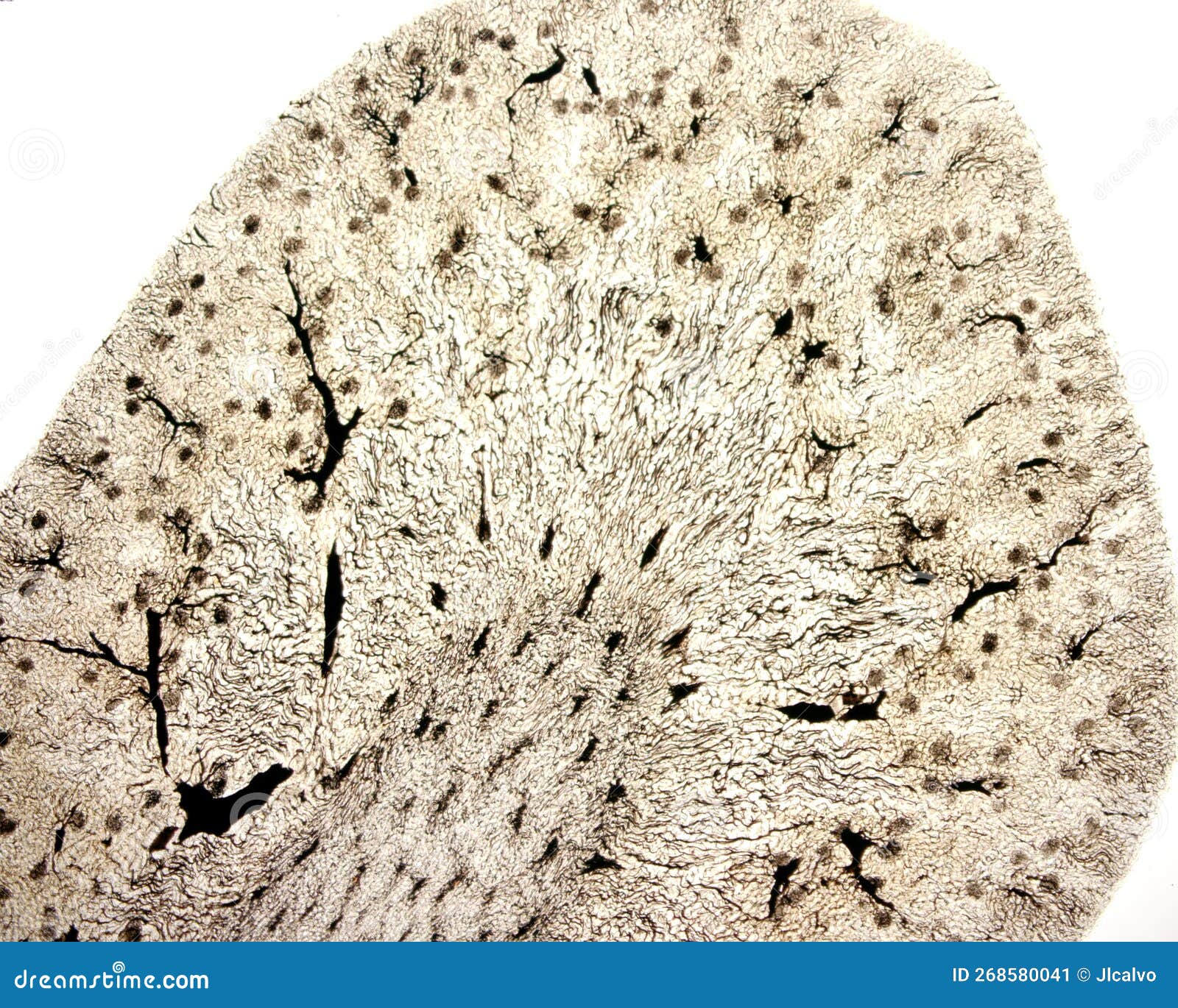 Kidney. Blood vessels stock image. Image of blood, histological - 268580041