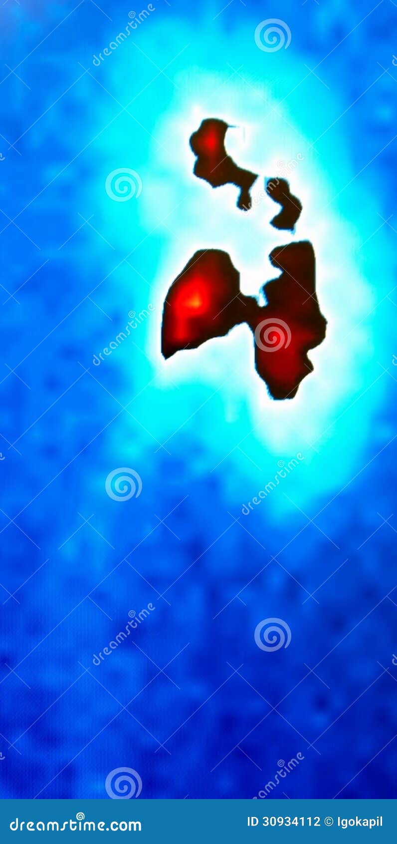 Bladder ,nuclear Medicine Stock Image | CartoonDealer.com #30941755