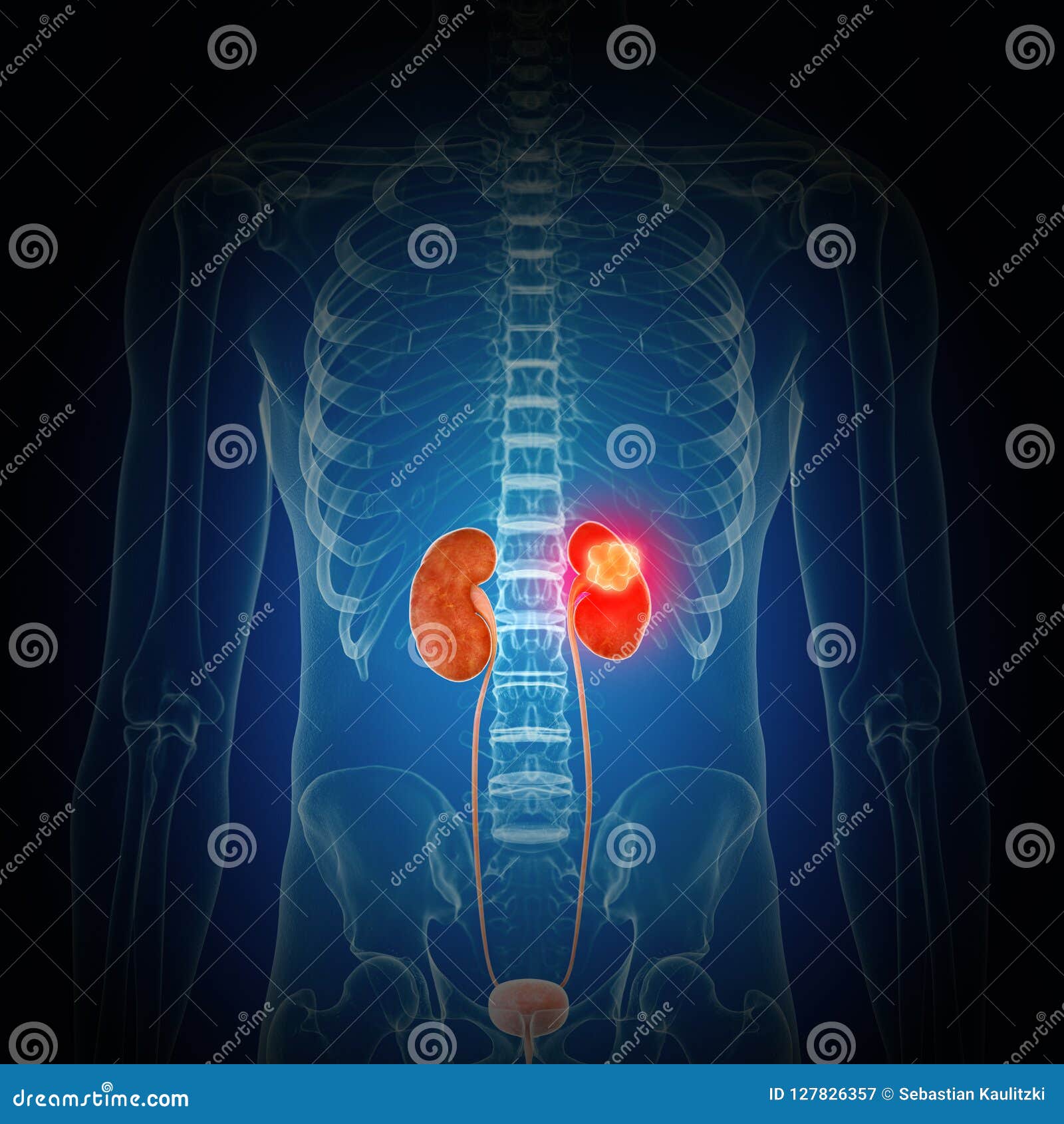 Kidney Cancer Banner. Causes. Diagnostics. Line Icons Set. Vector Signs ...