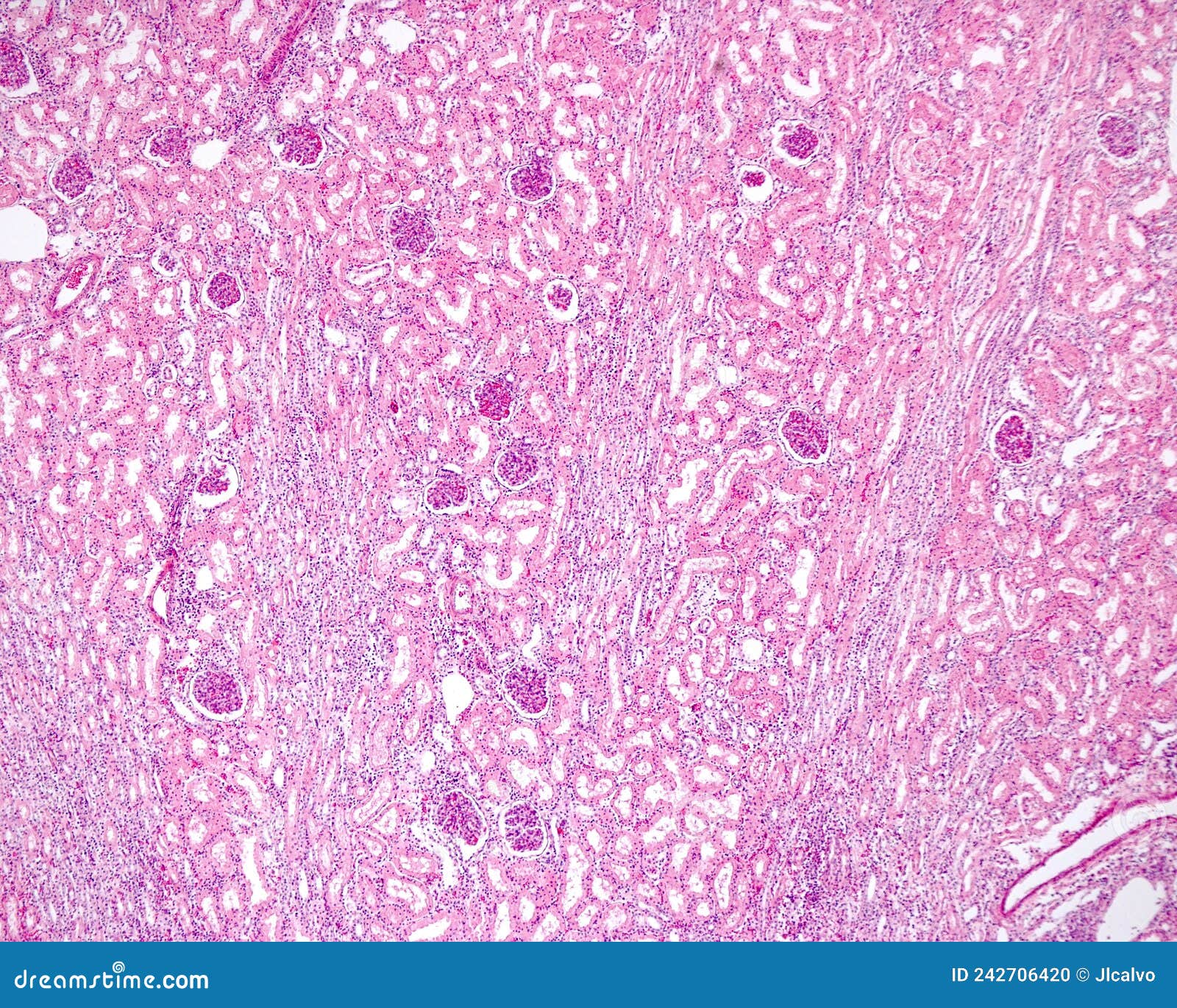 Kidney Cortex. Medullary Rays Stock Illustration - Illustration of ...