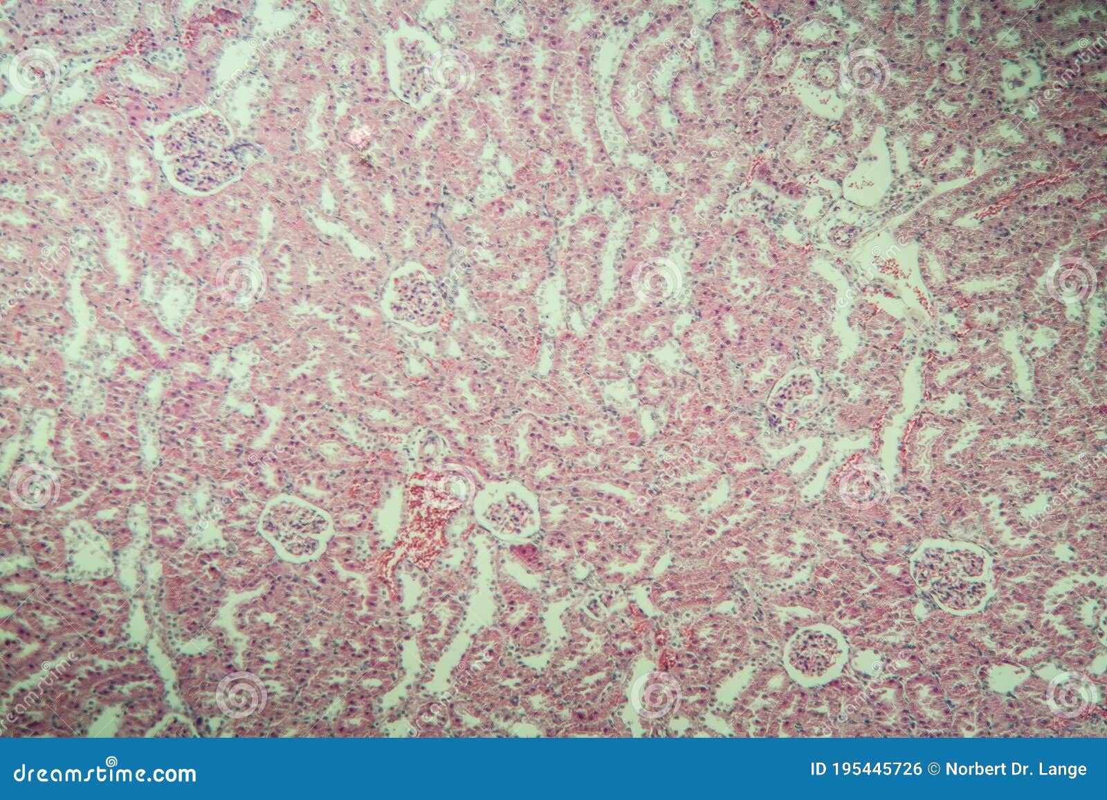 Kidney Cortex Under the Microscope Stock Photo - Image of magnification ...