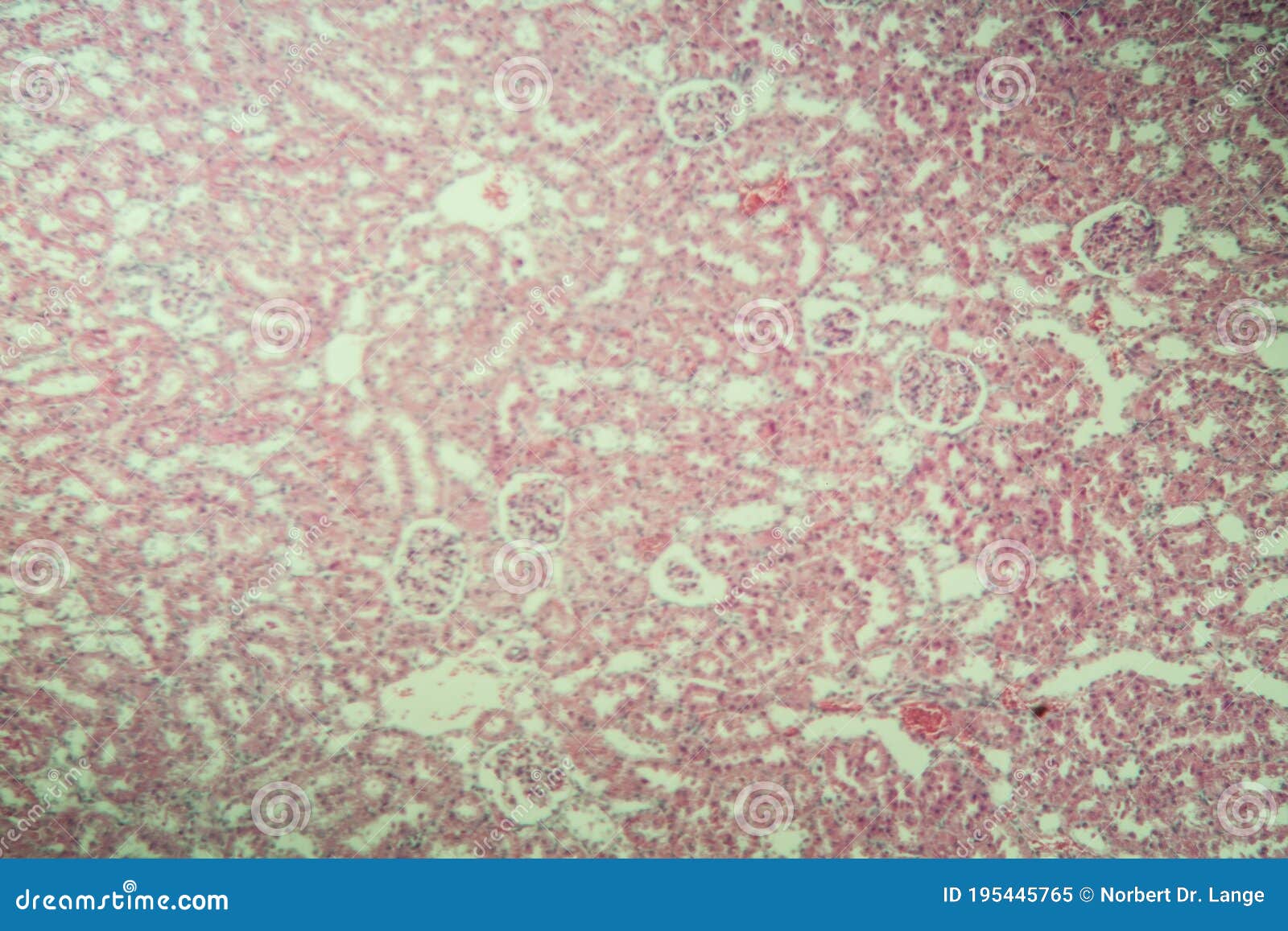 Kidney Cortex Under the Microscope Stock Image - Image of enlargement ...