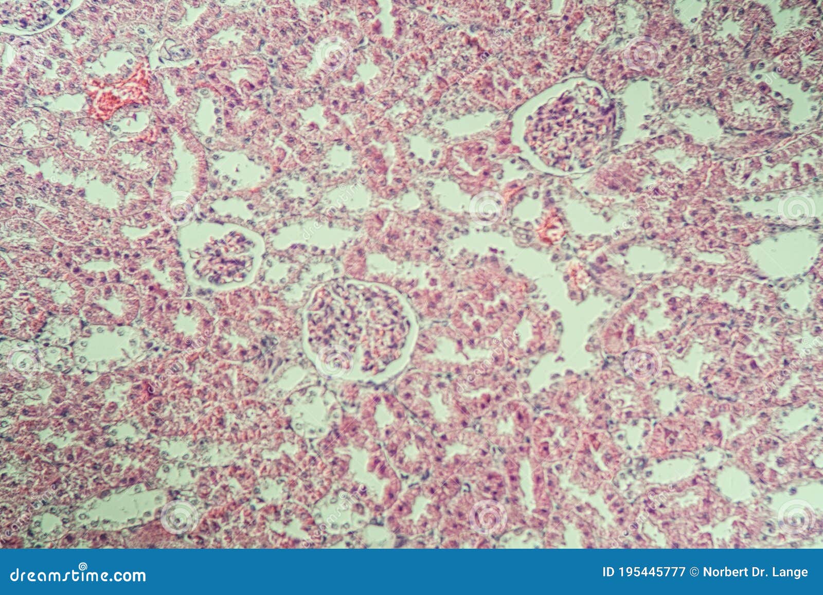 Kidney Cortex Under the Microscope Stock Image - Image of nephron ...