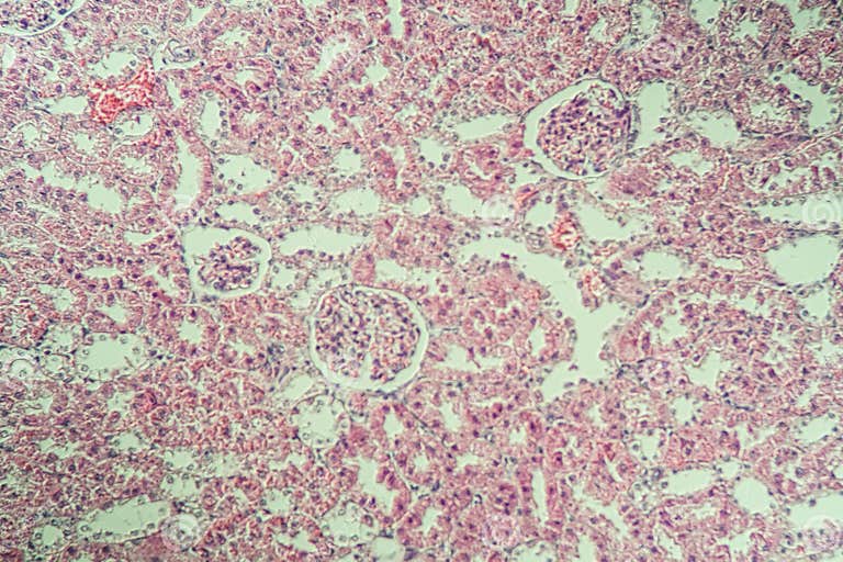 Kidney Cortex Under the Microscope Stock Image - Image of nephron ...