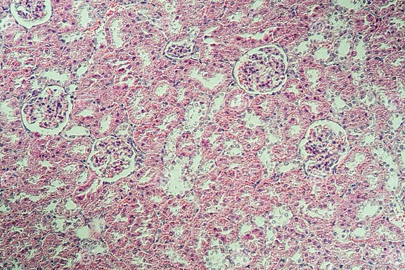 Kidney Cortex Under the Microscope Stock Photo - Image of healing ...