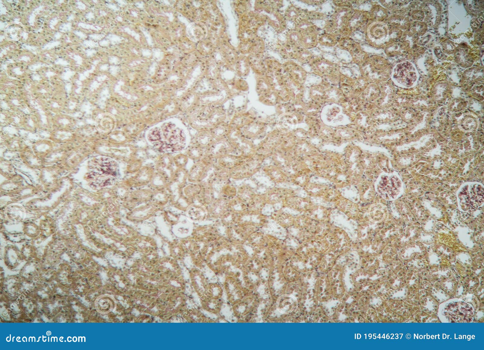 Kidney Cortex Under the Microscope Stock Image - Image of diagnosis ...