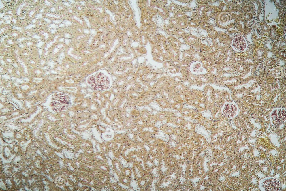 Kidney Cortex Under the Microscope Stock Image - Image of diagnosis ...