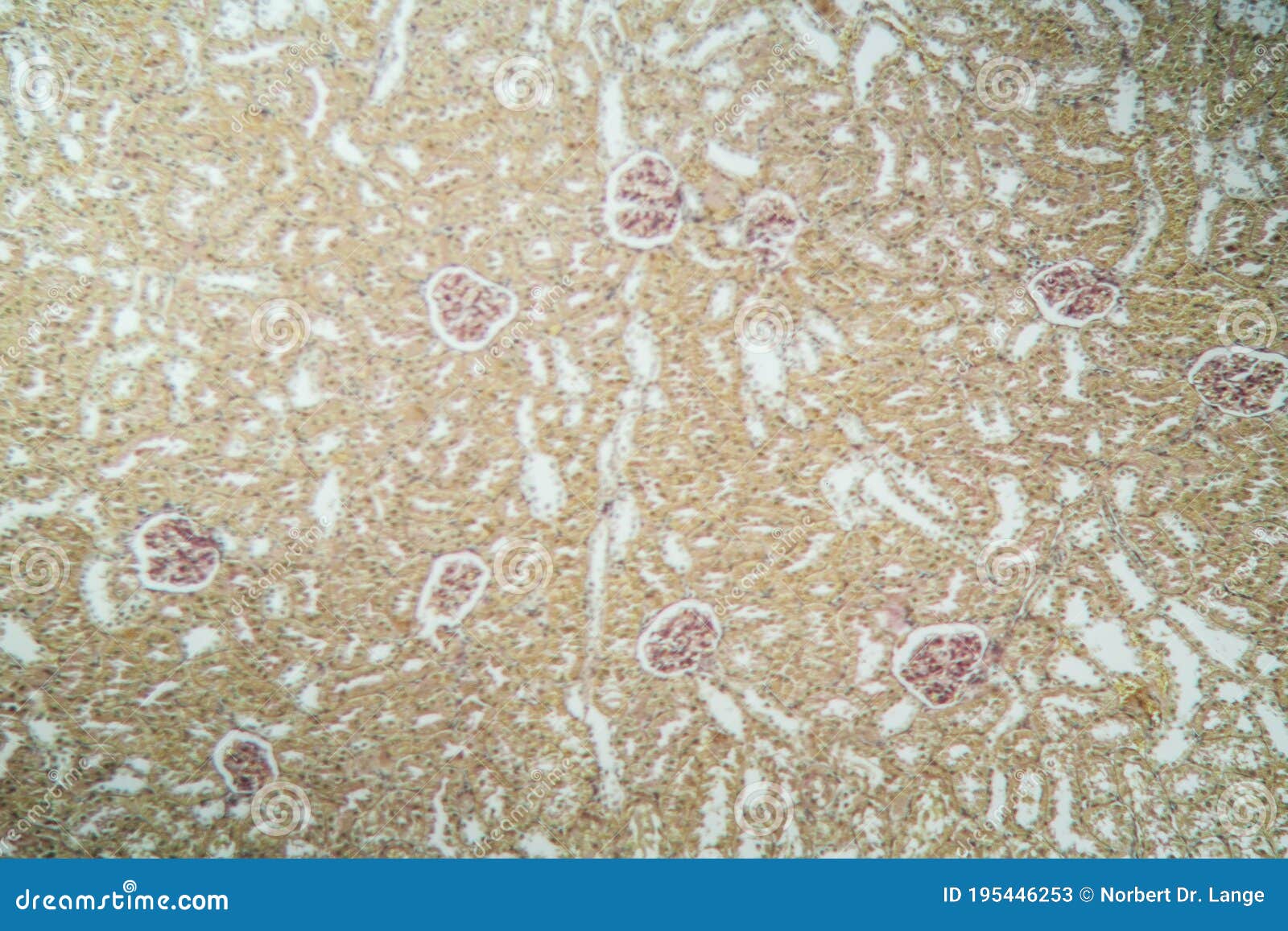 Kidney Cortex Under the Microscope Stock Image - Image of enlargement ...