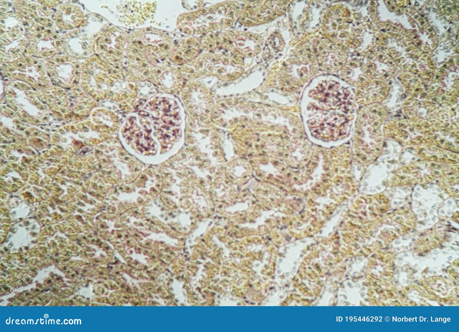 Kidney Cortex Under the Microscope Stock Photo - Image of bowman ...