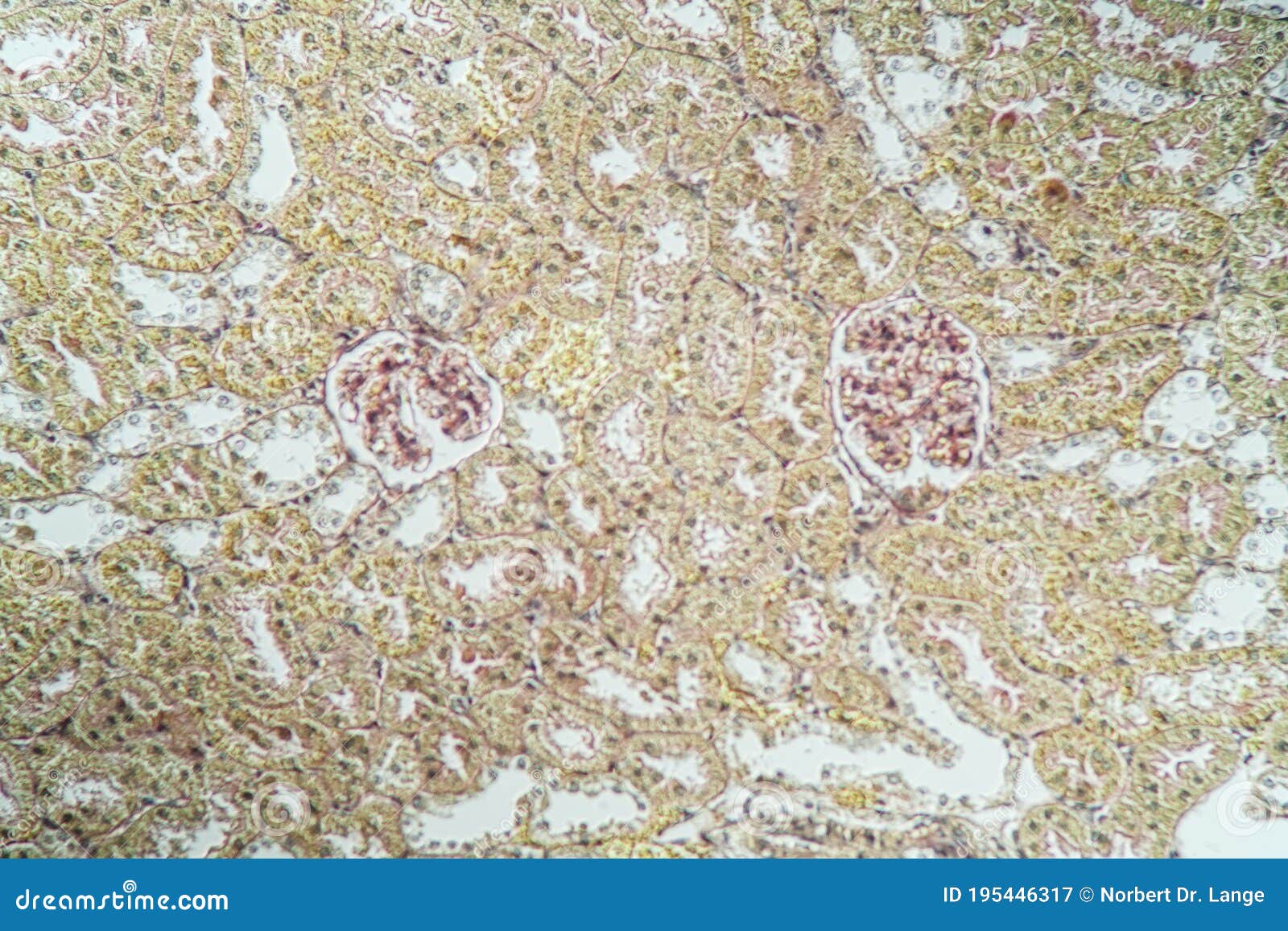 Kidney Cortex Under the Microscope Stock Image - Image of tiny, cortex ...