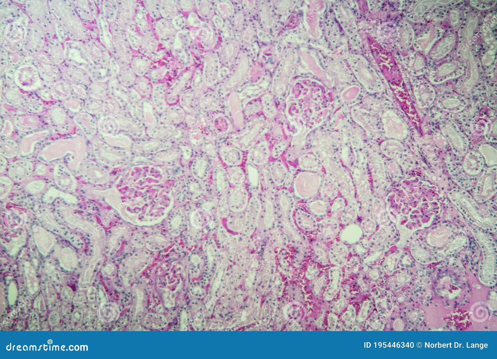 Kidney Cortex Under the Microscope Stock Photo - Image of research ...