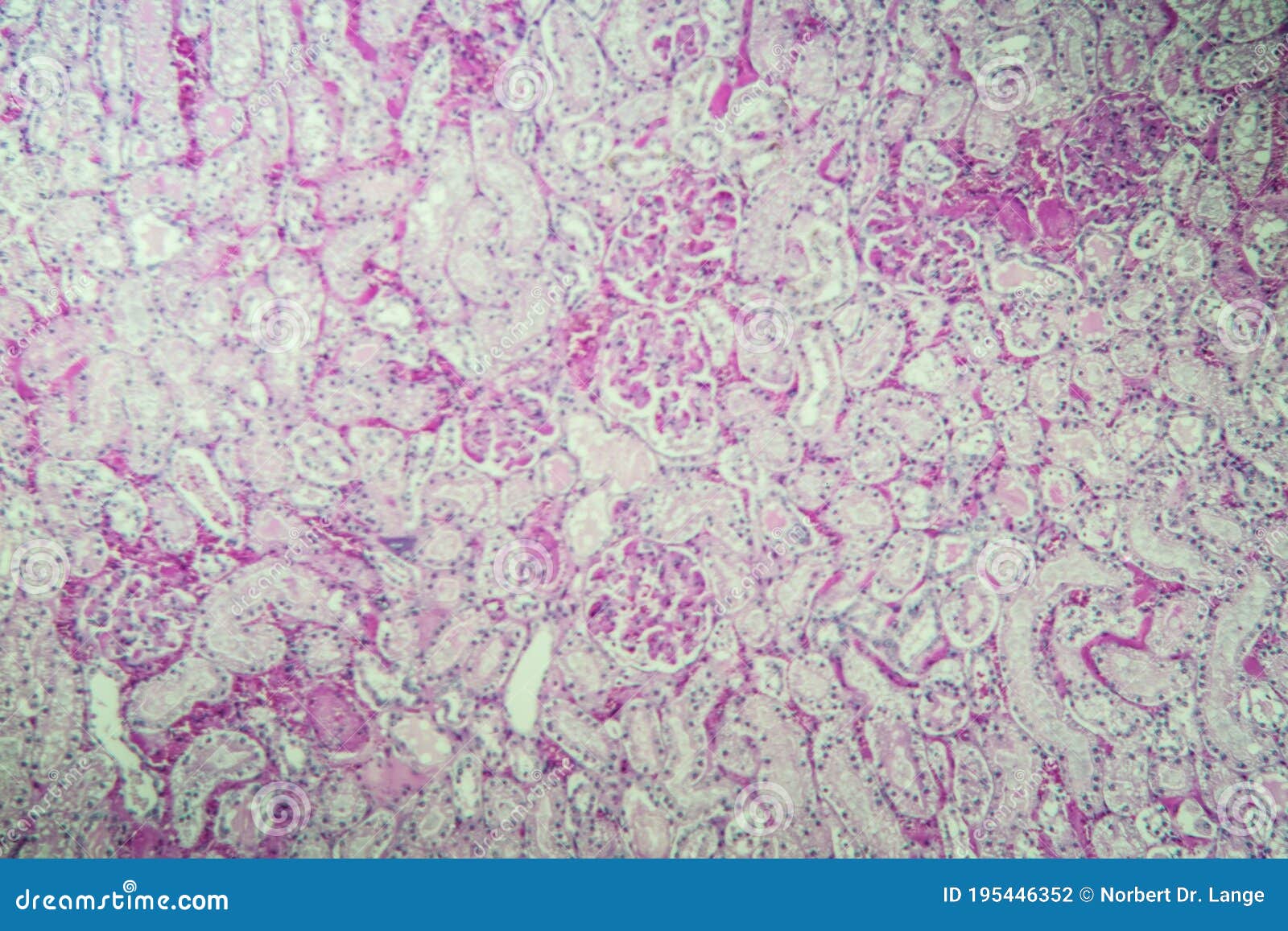 Kidney Cortex Under the Microscope Stock Photo - Image of tissue ...