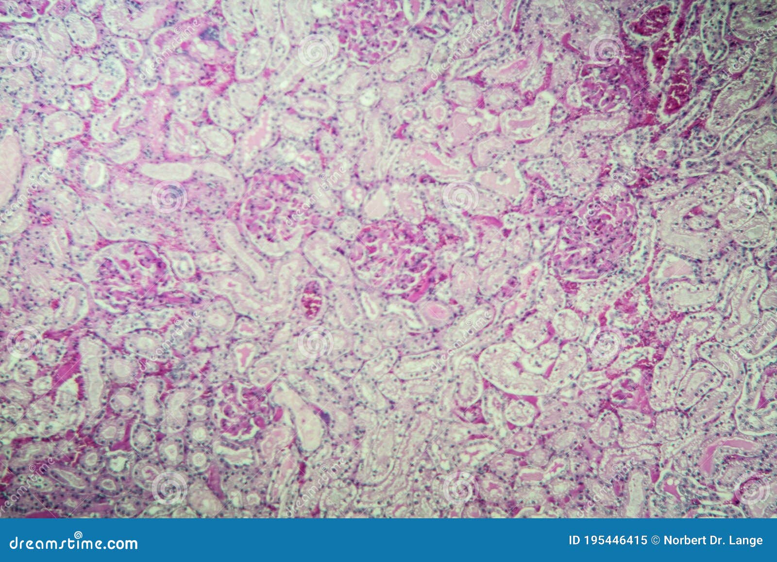 Kidney Cortex Under the Microscope Stock Image - Image of glomeruli ...