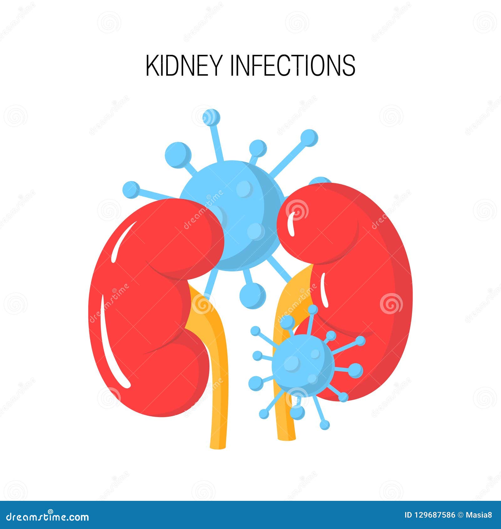 Kidney Infection Vector Concept Stock Vector - Illustration of ...