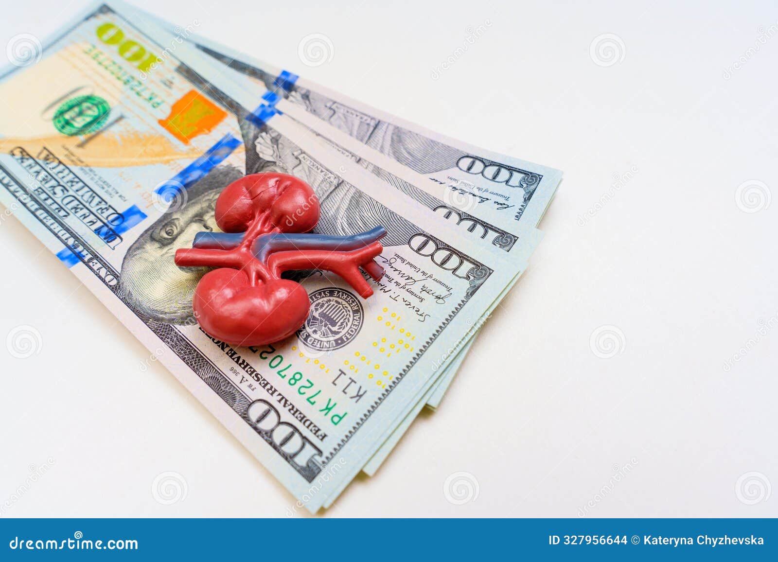 Kidney Model Isolated On White Background With Clipping Path. Chronic ...