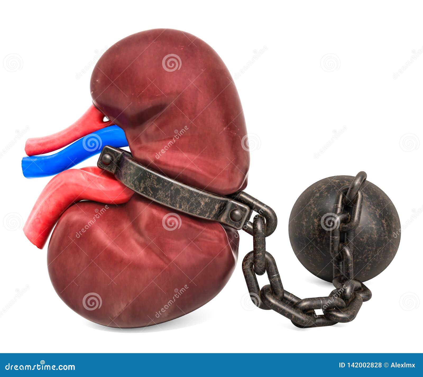 Kidney Pain Concept. Human Kidney with Shackle Stock Illustration ...