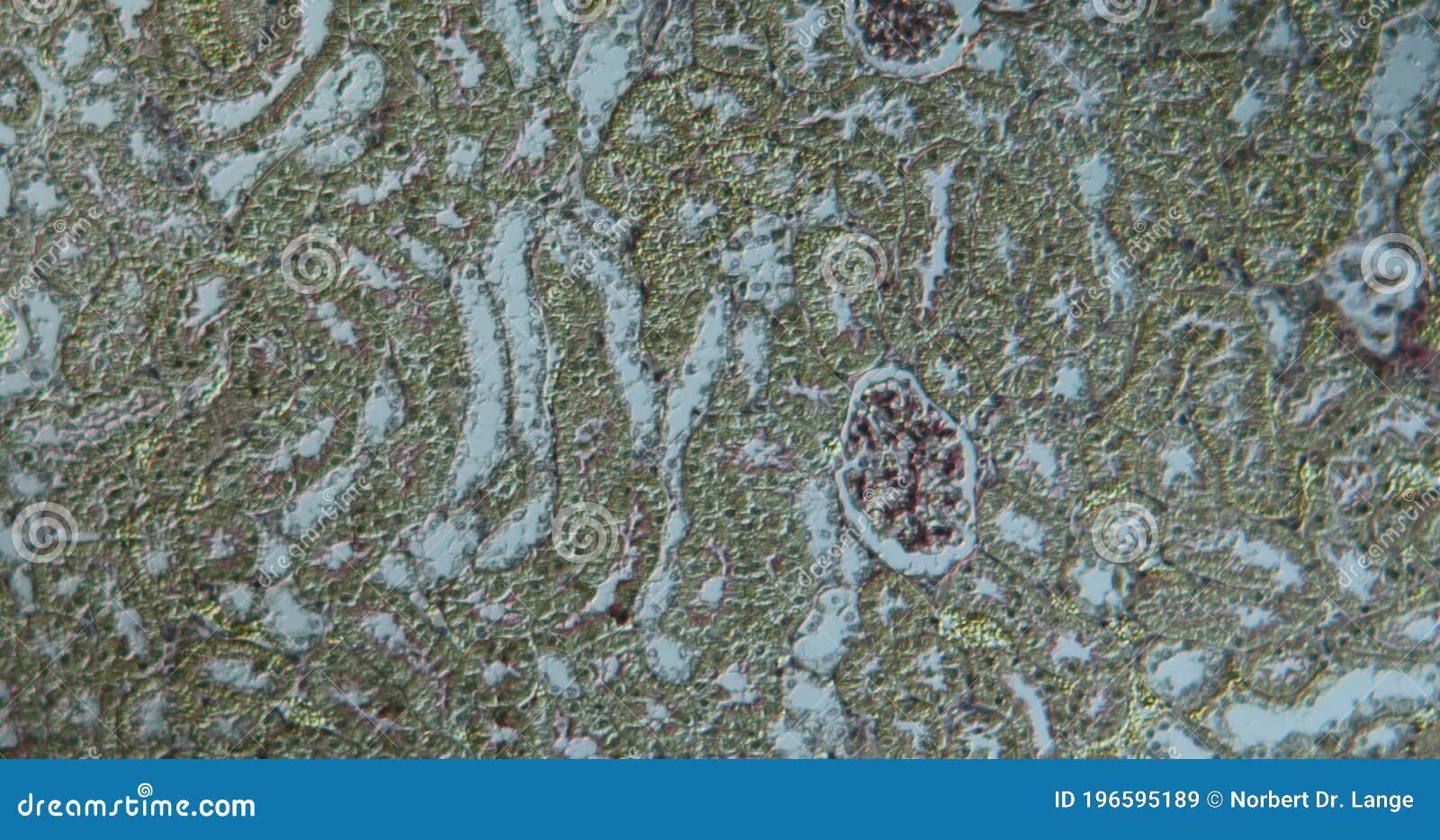 Kidney of the rat stock video. Video of medic, tomography - 196595189