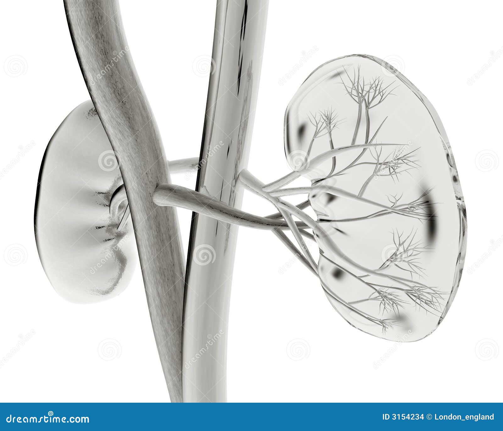 Kidney X-ray stock illustration. Illustration of artery - 3154234
