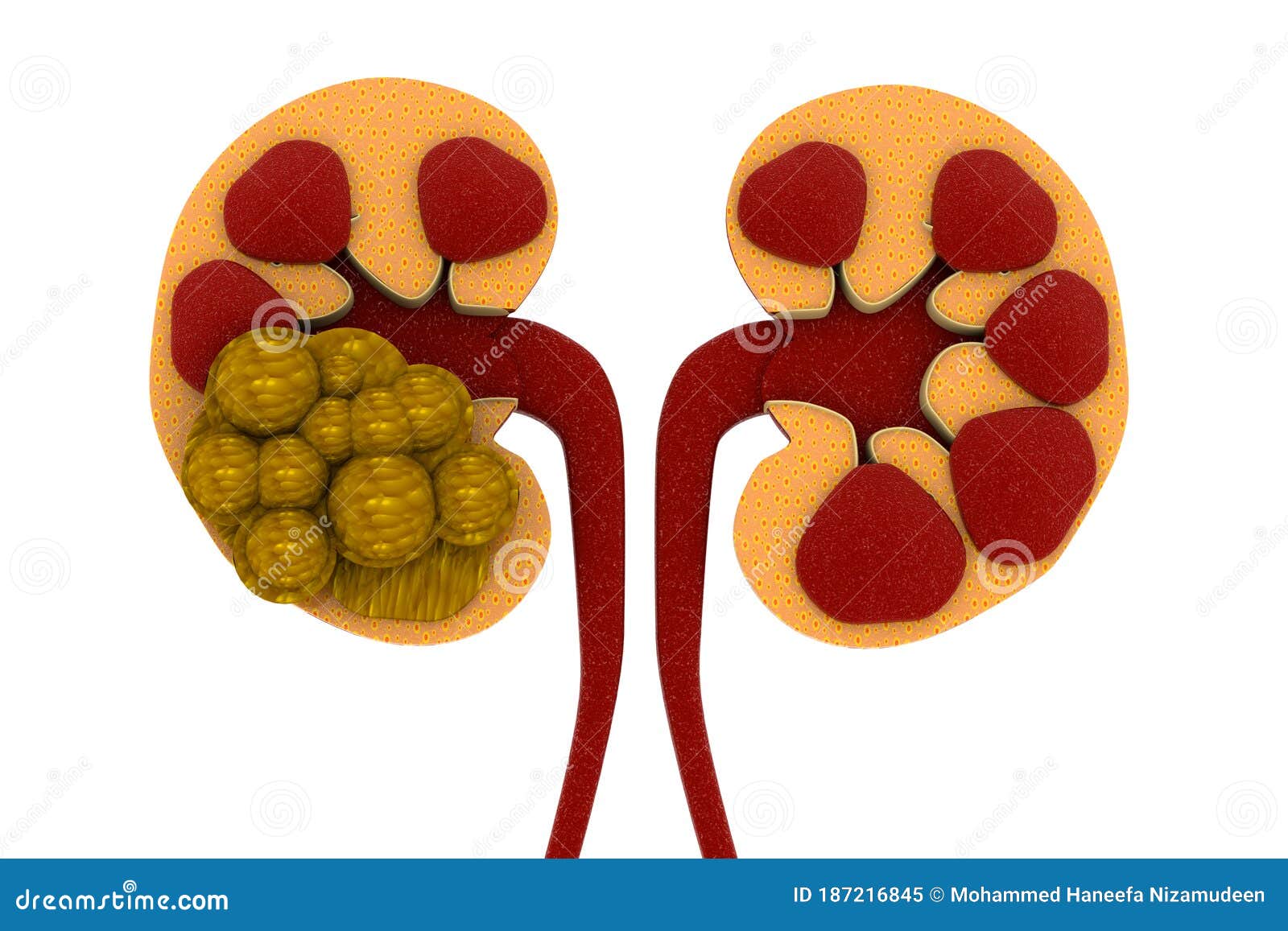 Dog`s Kidney Stone Symptoms.Infographic Icons With Different Signs And ...