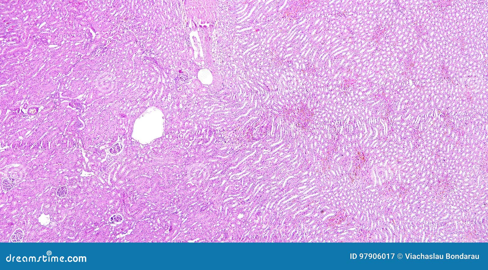 Kidney tissue of a human stock image. Image of micro - 97906017