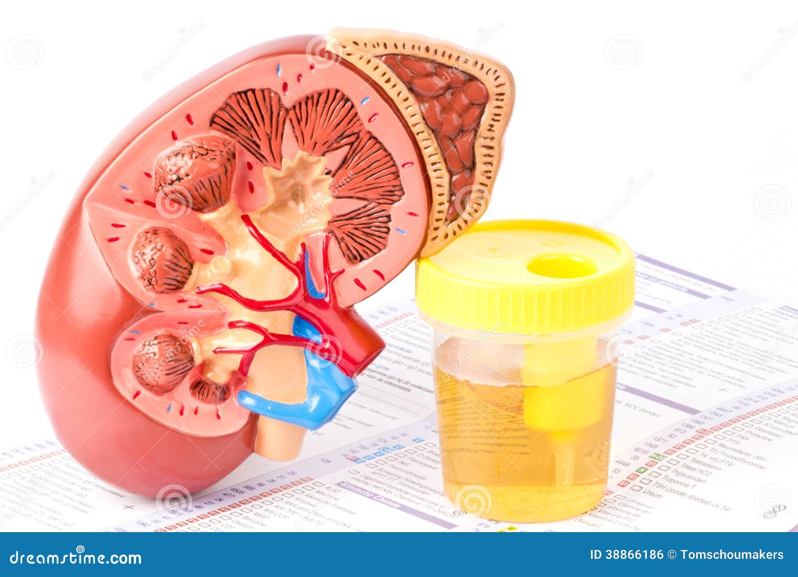 Urine Sample With A Petri Dish On Analysis Forms Stock Photo ...