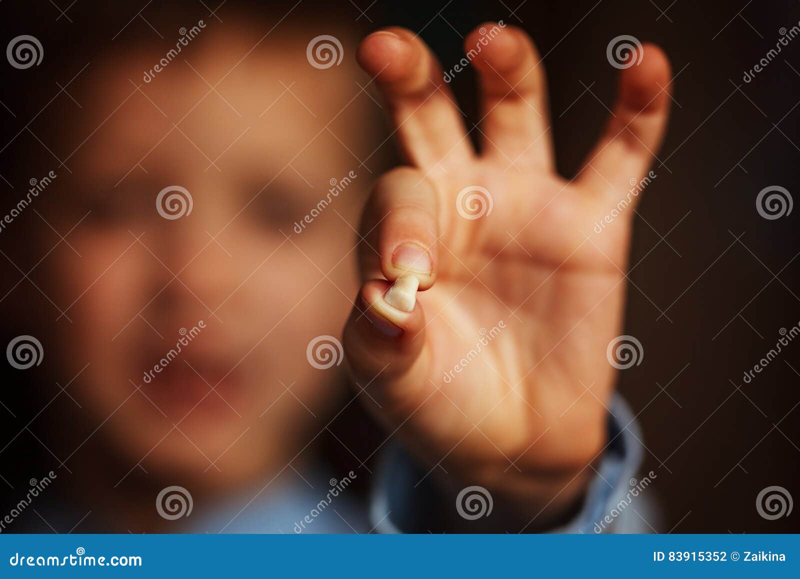 Kids Hand with One Milk Tooth. First Tooth Lost. Stock Photo - Image of ...