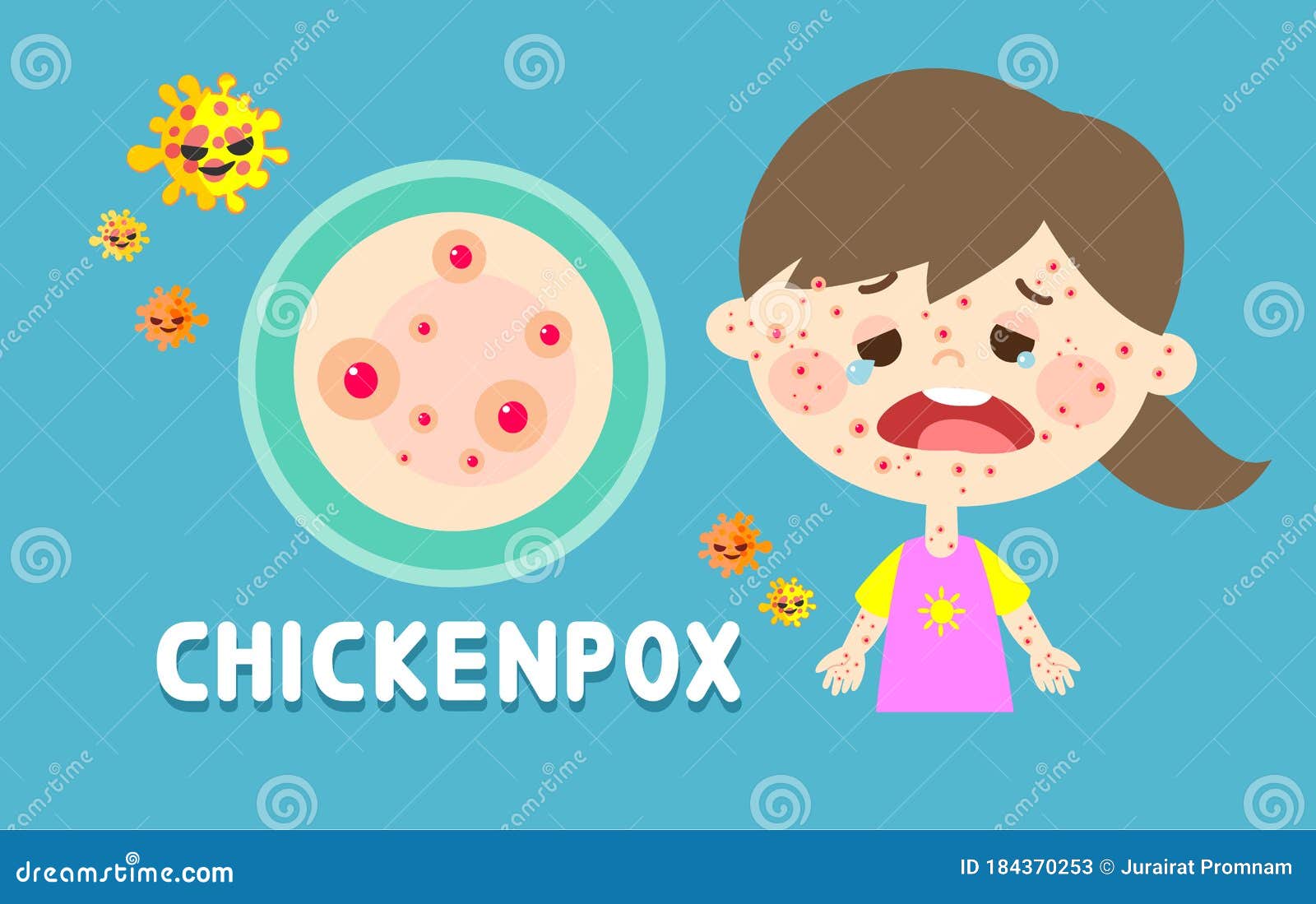 Chickenpox Kids Cartoon Vector | CartoonDealer.com #251985