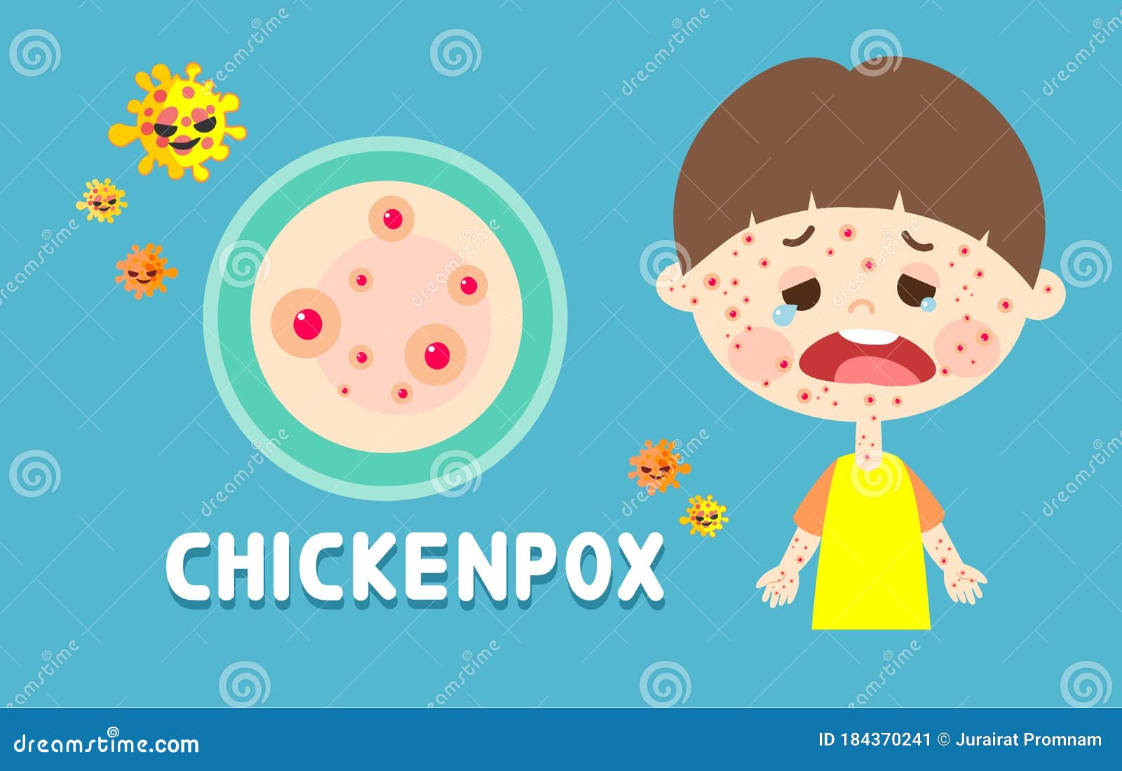 Chickenpox Kids Cartoon Vector | CartoonDealer.com #251985