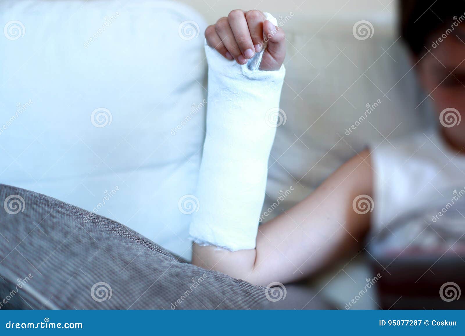 Kind met gebroken hand stock afbeelding. Image of lang - 95077287