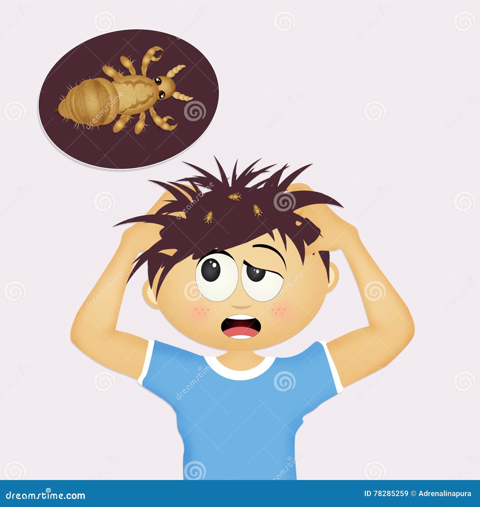 Kind met hoofdluizen stock illustratie. Illustration of diagnose - 78285259